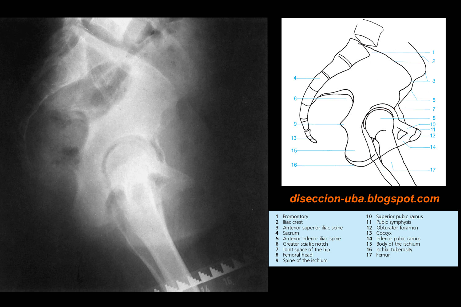 rx: Rx pelvis vista de Guthmann