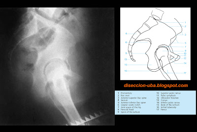 rx: Rx pelvis vista de Guthmann