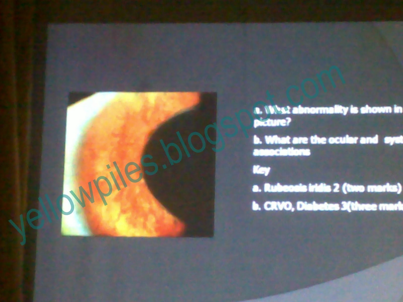 BEST CHOICE: Eye ospe papers 1