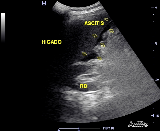 Cuando se usa la Logica y la Clinica