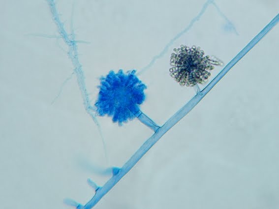 Fun With Microbiology (What's Buggin' You?): Syncephalastrum species