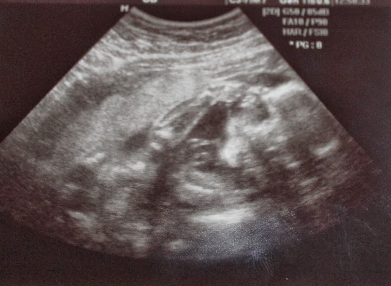 Pikku-Buu: Kivekset ja pippeli