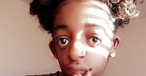 HitbizAfrika: This girl born with facial deformity says "If I can look ...