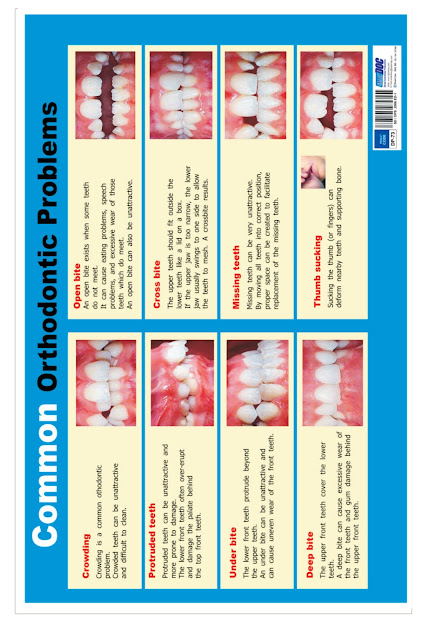 Dental Posters: Dental Posters