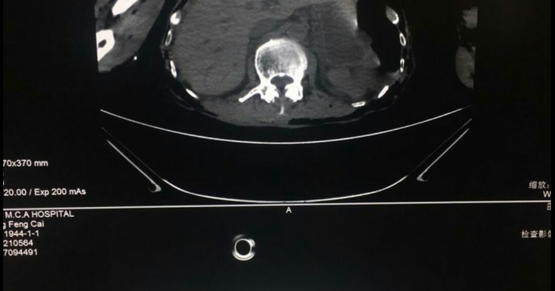 Jurusan Teknik Radiodiagnostik dan Radioterapi