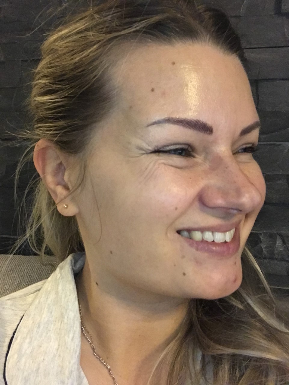 I've been Botoxed | Mimí Jasmin