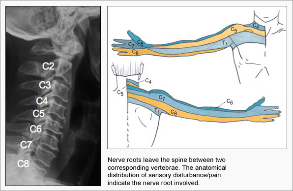 Cervical spine compression - accessfeti