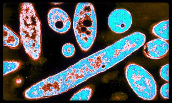 Legionella or Legionnaire's disease and symptoms of pneumonia - what ...