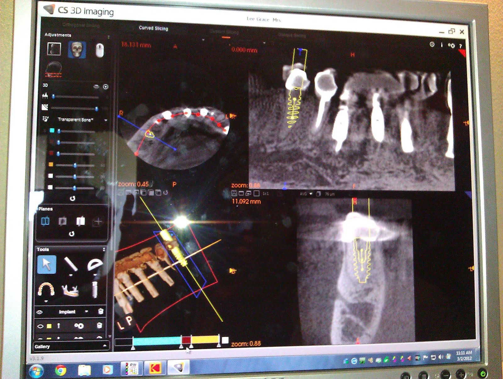 A Biting Chance Drneilmcleod.com dentistry that lasts- quality that ...