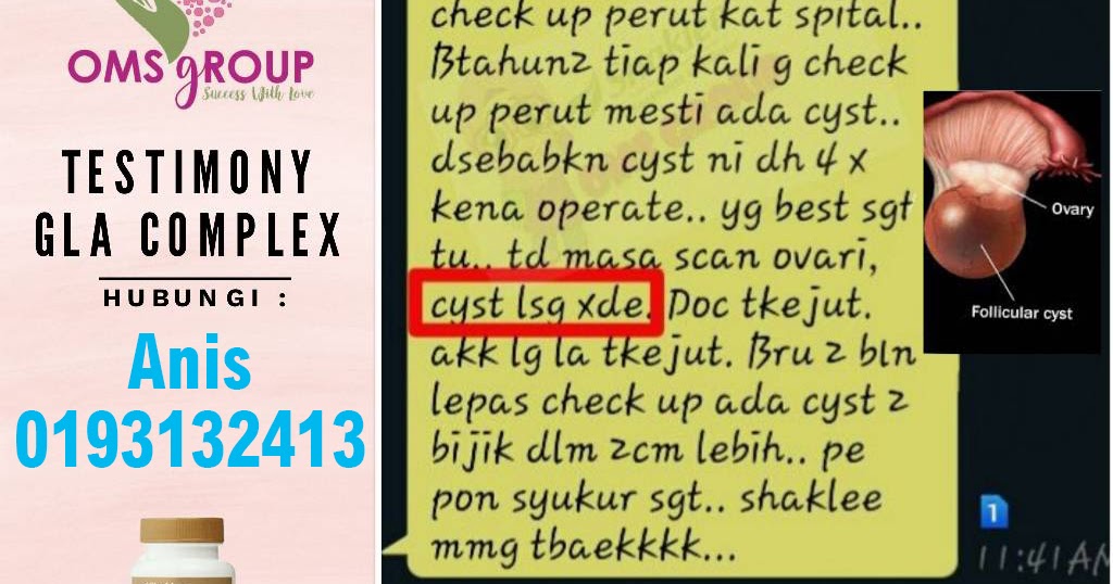 Berjaya Kecutkan Cyst, Fibroid Dengan Vitamin Shaklee | Beli Vitamin ...