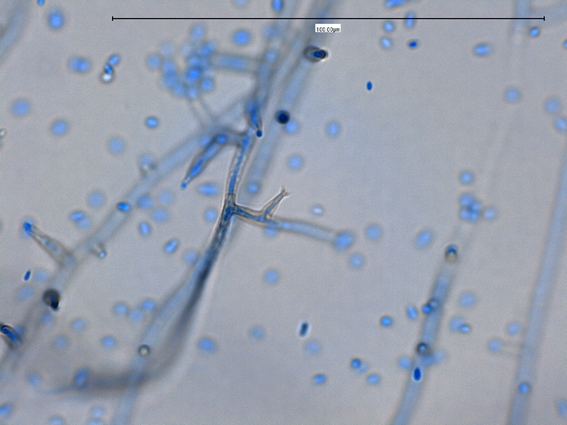 Fun With Microbiology (What's Buggin' You?): Pleruostomophora richardsiae