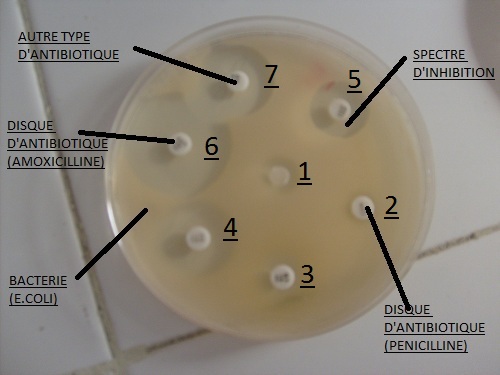 L'ANTIBIOGRAMME - france ~ COURS de la pharmacie