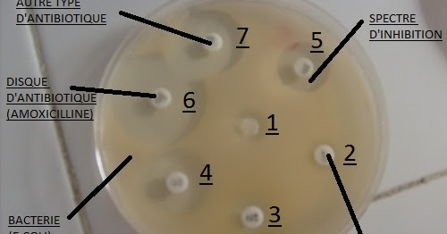 L'ANTIBIOGRAMME - france ~ COURS de la pharmacie