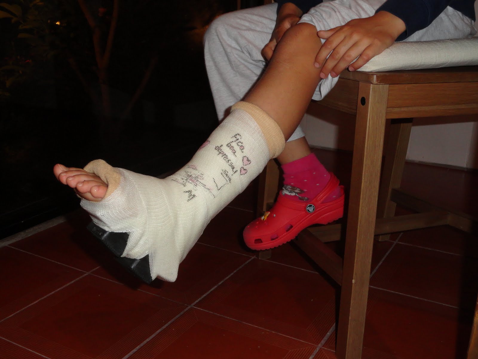 O Homem sonha o destino nasce: Perna engessada