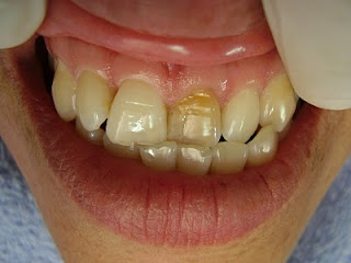 Casos Clinicos Odontologicos