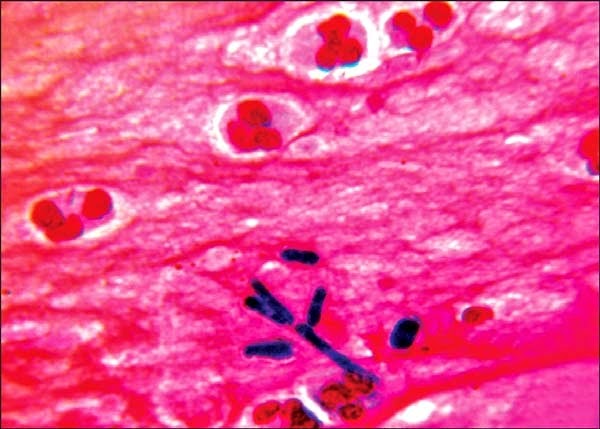 Staining Procedure for Rapid Identification of Fungi | Tuyenlab