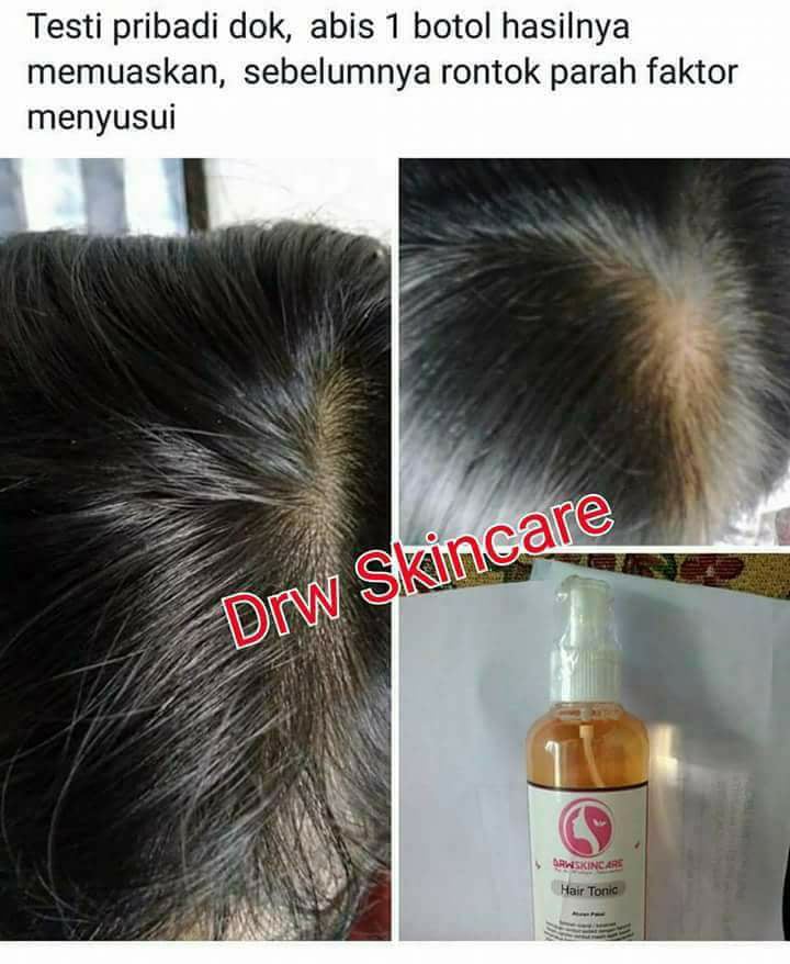 Testimoni Hair tonic Drw Skincare - Agen DRW Skincare