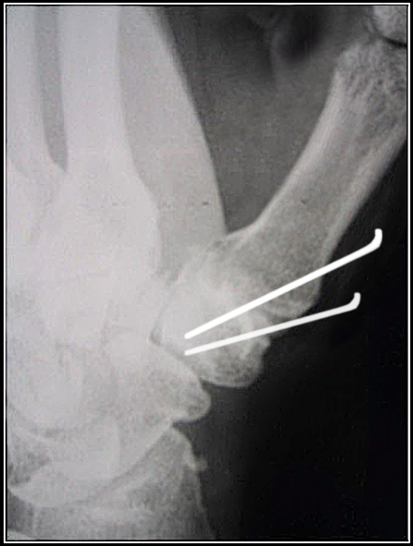 Anatamation: where Anatomy meets Animation: 9/2/12 - 9/9/12