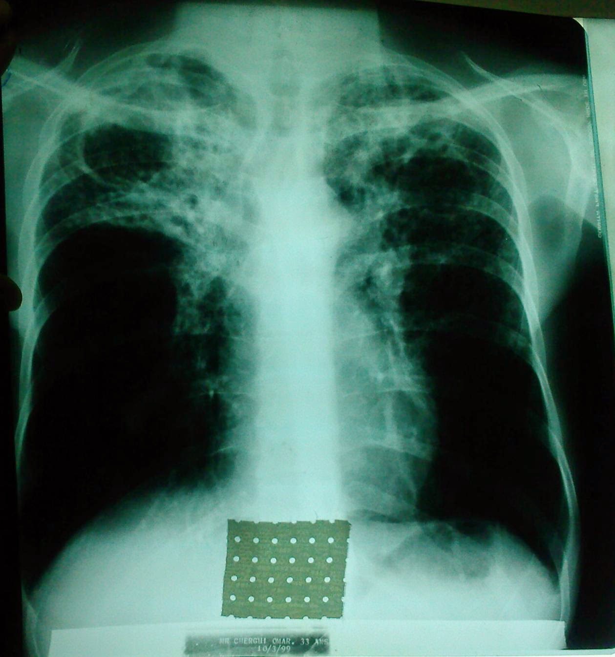 Telethorax