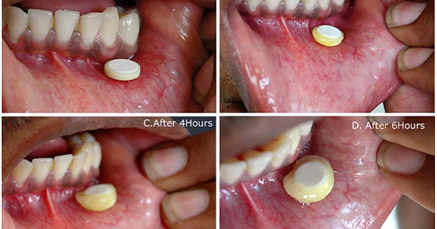 Medical Attention: THE BUCCAL ROUTE OF DRUG ADMINISTRATION