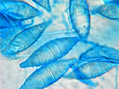 Fun With Microbiology (What's Buggin' You?): Microsporum canis