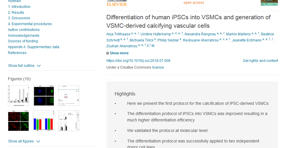 Calcification of human iPSC-derived VSMCs
