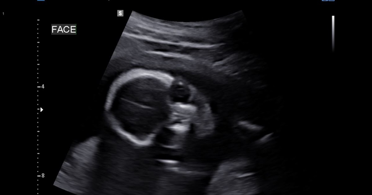 BARNETT BABY: 18 WEEK ULTRASOUND!!!