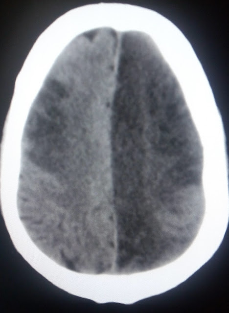 Snake Bite and Radiology - Sumer's Radiology Blog