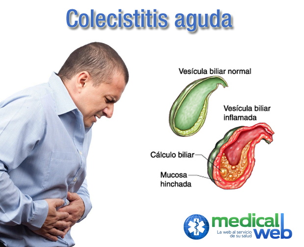 Cirugía Gastrointestinal - Cátedra de Cirugía III: EVByCB - Cuarta ...