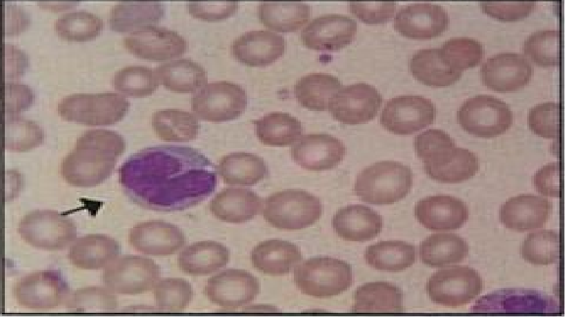 fichero hematologia: Monocito