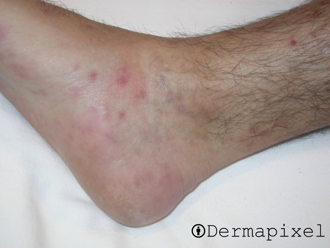 Dermapixel: abril 2012