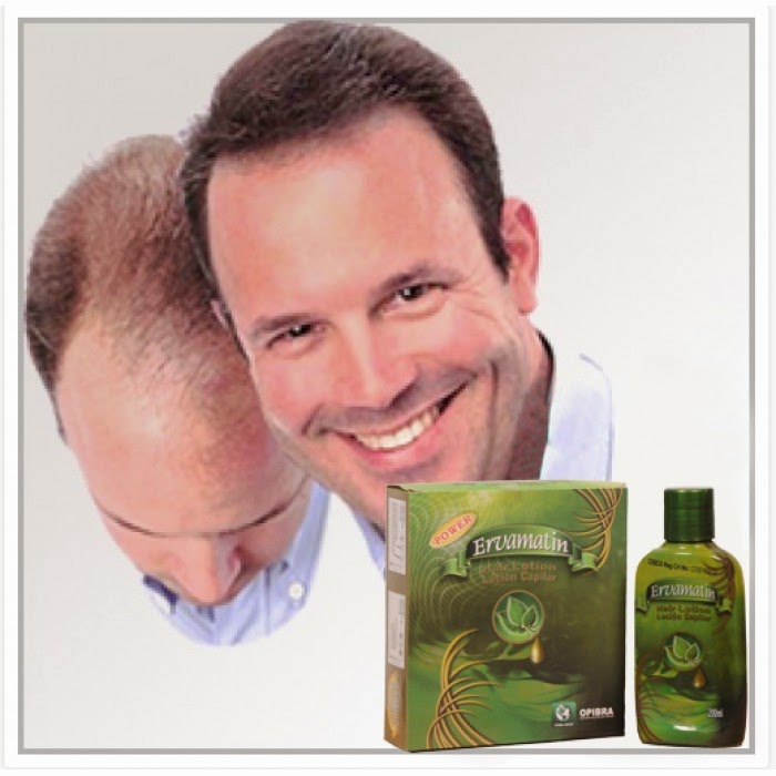Ervamatin Hair Lotion: Hairfall Dandruff