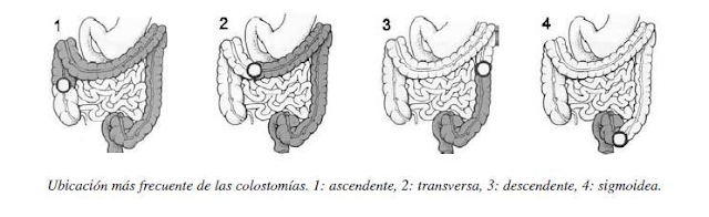 ELIMINACIÓN: Estomas