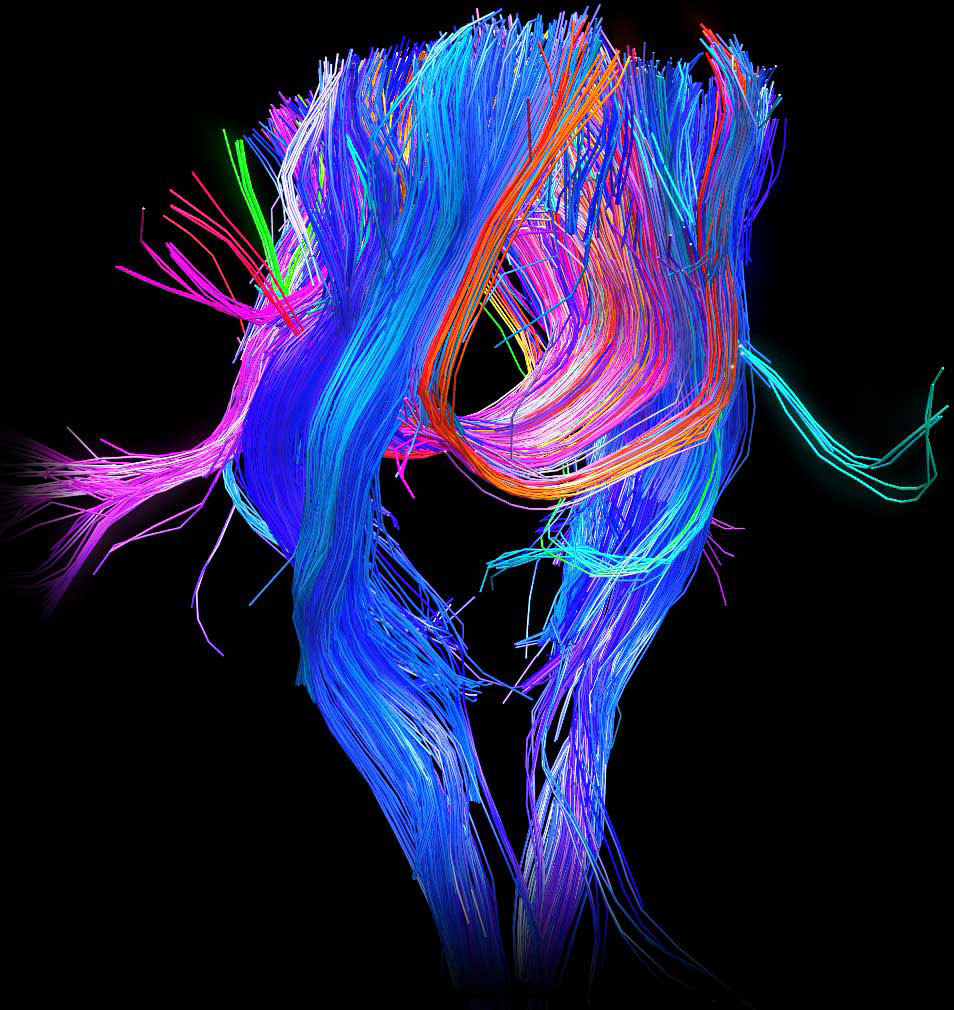 The Neurocritic: Good Brain / Bad Brain