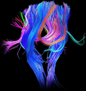 The Neurocritic: September 2015