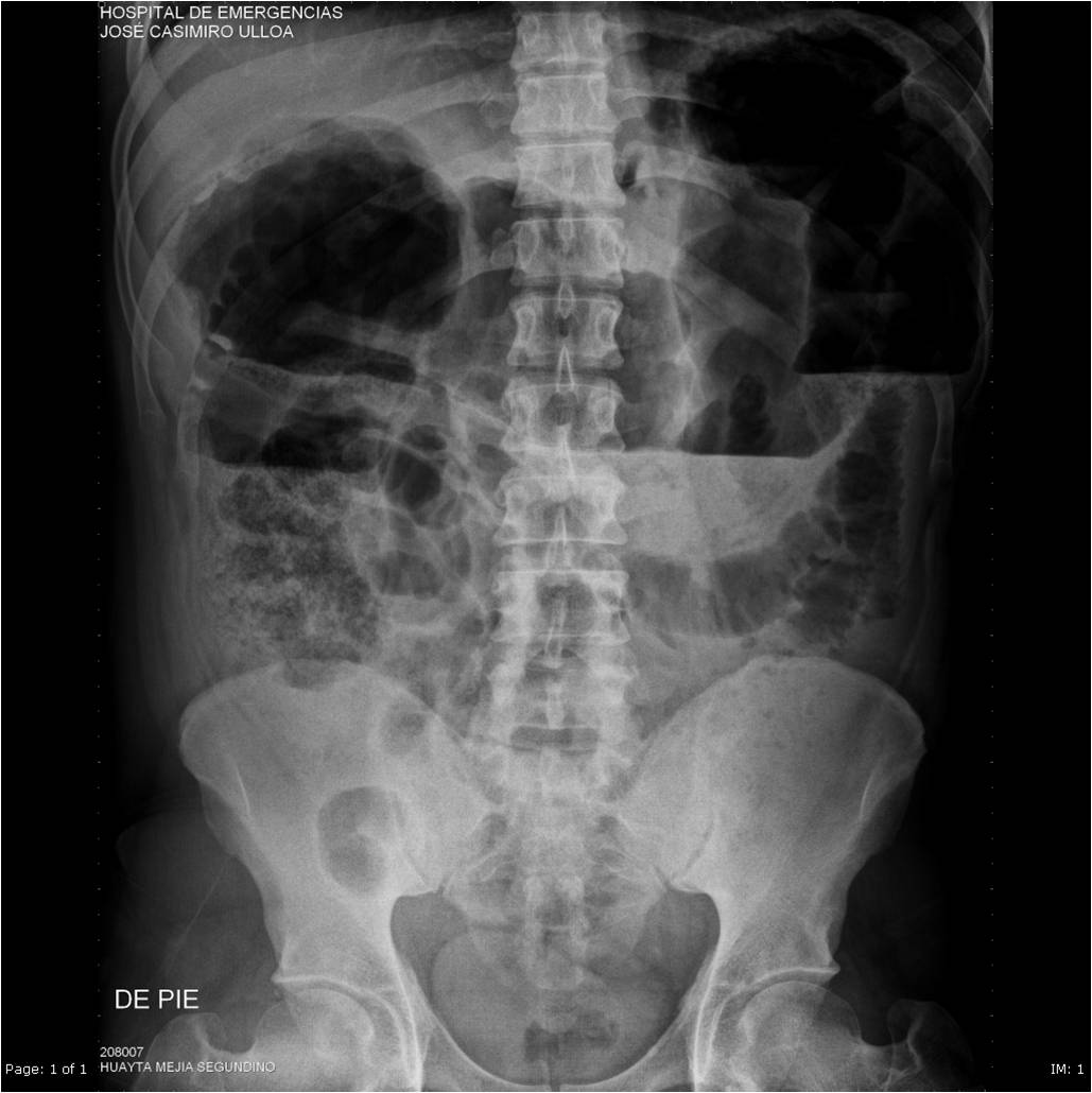 MEDICINA: INTERPRETACIÓN DE LAS RADIOGRAFÍAS DE ABDOMEN EN URGENCIAS