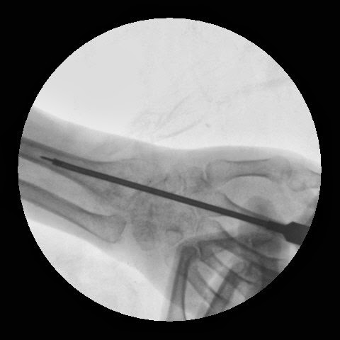 MY LOVE2009: KIM KIRSCHNER GÃY TRONG LÒNG TỦY