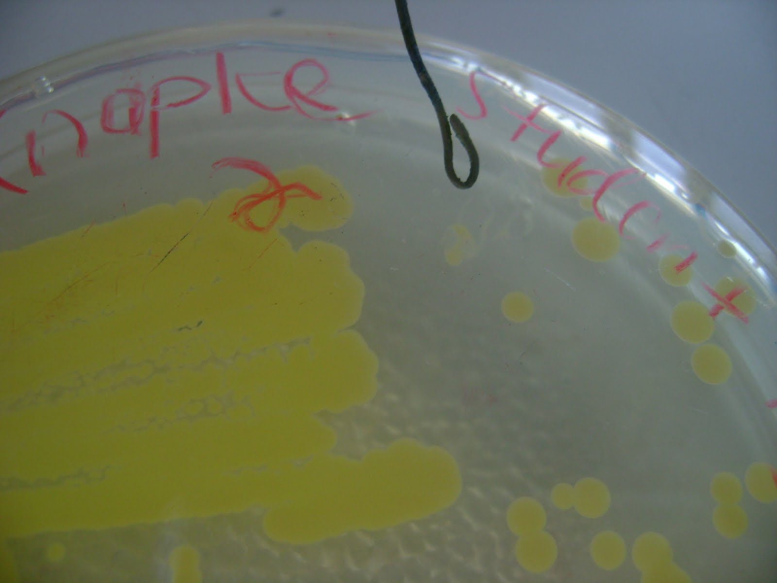 MedicALI Microbiology: Preparing and Staining a Bacterial Smear