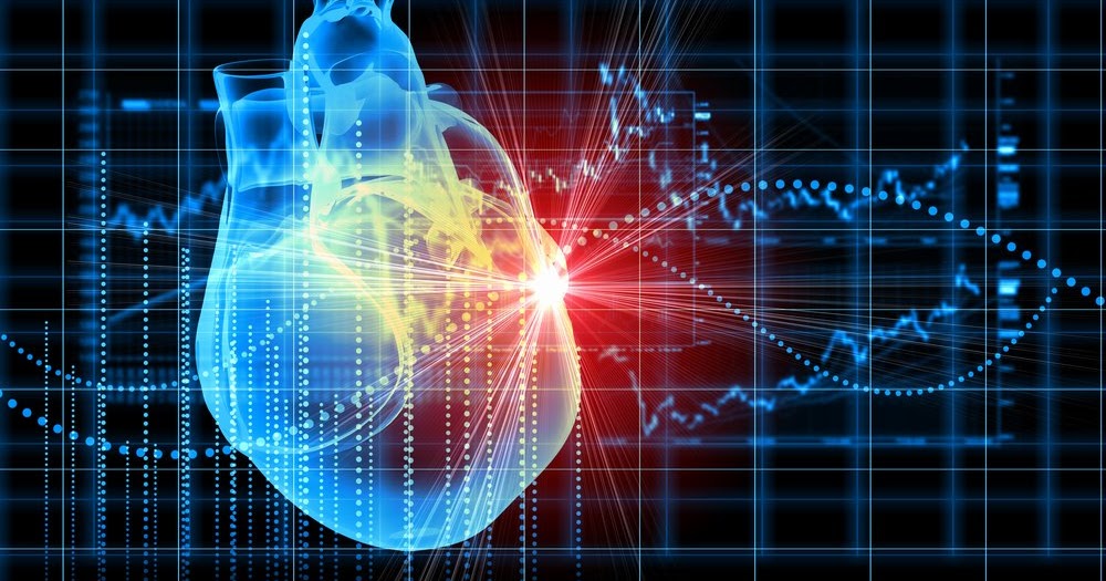 MACHINE LEARNING IN DETECTION OF HEART ARRHYTHMIAS