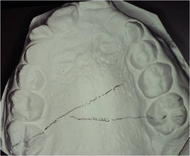 practical orthodontics: Diagnosis and treatment of mesially rotated ...