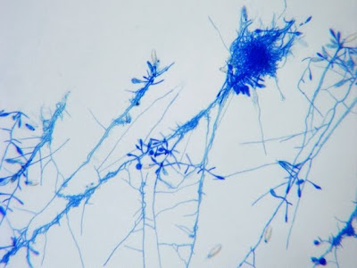 Fun With Microbiology (What's Buggin' You?): Microsporum canis