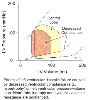 Heart Failure With Preserved Lv Function | semashow.com