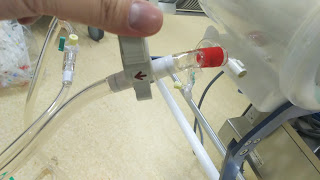ECMO（PCPS）の基本原理と観察項目-臨床工学技士による呼吸療法勉強会