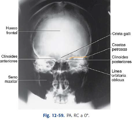 PRODUCCION Y TRATAMIENTO DE IMAGENES DIAGNOSTICAS: CAPITULO CRÁNEO Y ...