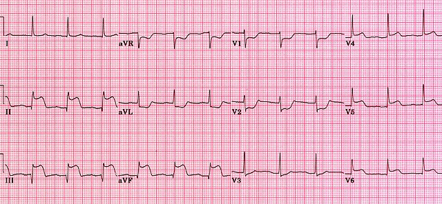 Learning how to read electrocardiograms (EKGs)