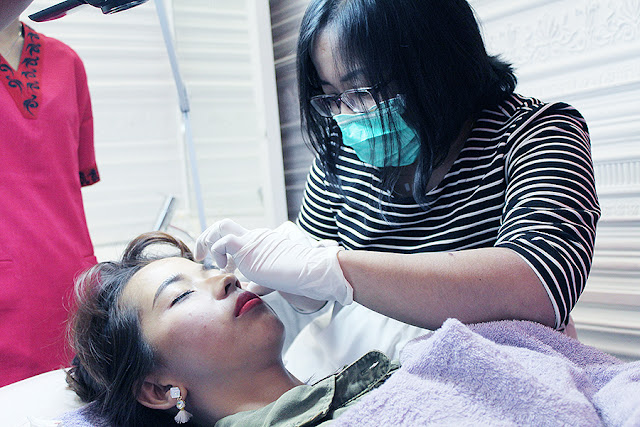 INJEKSI FILLER UNTUK HILANGKAN KANTONG MATA - Sasyachi Beauty Diary