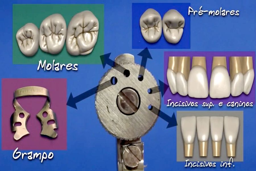 ISOLAMENTO ABSOLUTO: Técnica convencional passo a passo - Prof. Thiago ...