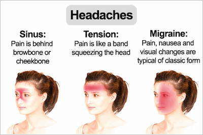 9 Punca Migrain dan Cara Mengatasi Migrain