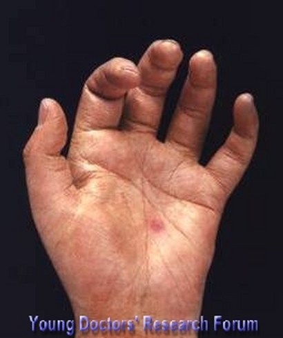 Some Important Findings in General Physical Examination (GPE) ~ YOUNG ...