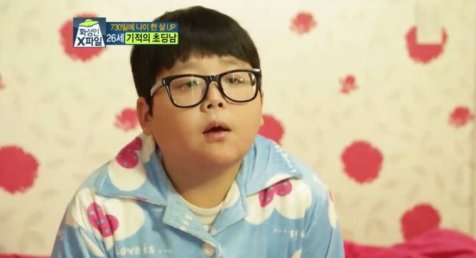 Highlander Syndrome adalah kelainan berhenti tumbuh dan terlihat ...